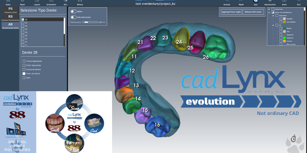 CAD Lynx Evolution: the new frontier of dental planning